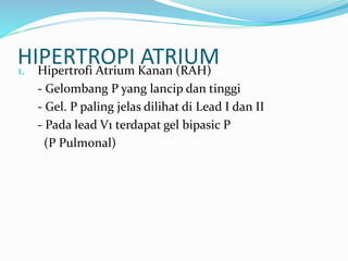 EKG, Hipertrofi Jantung | PPTX