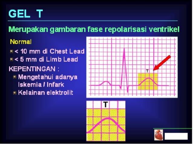 Ekg konsep dasar | PDF