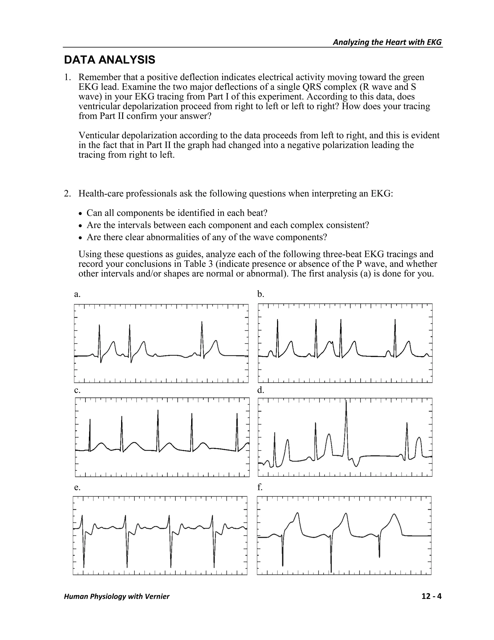 Ekg lab | PDF