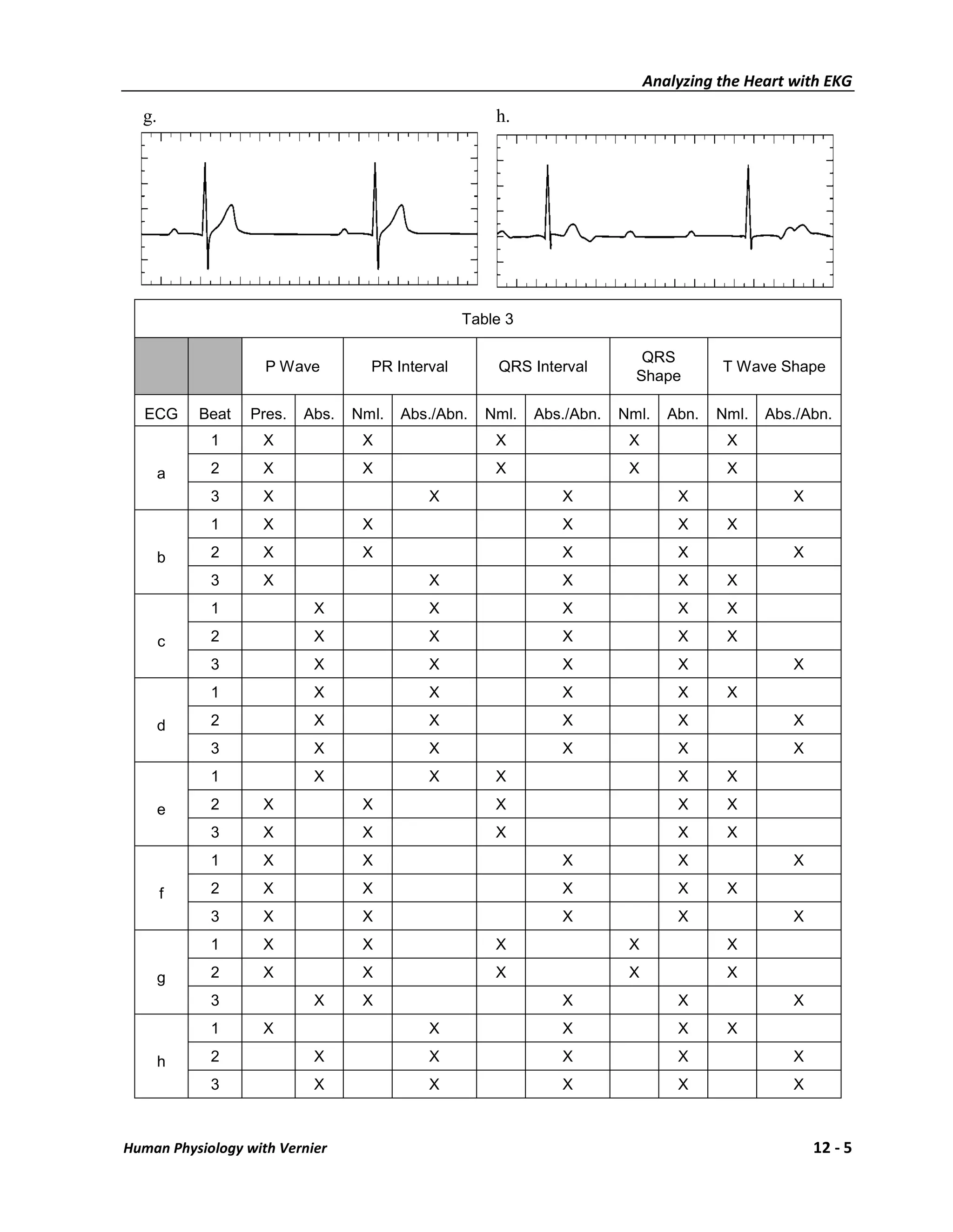 Ekg lab | PDF