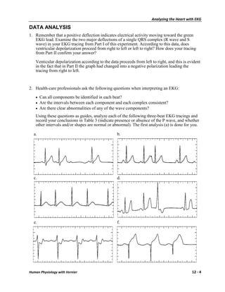 Ekg lab | PDF