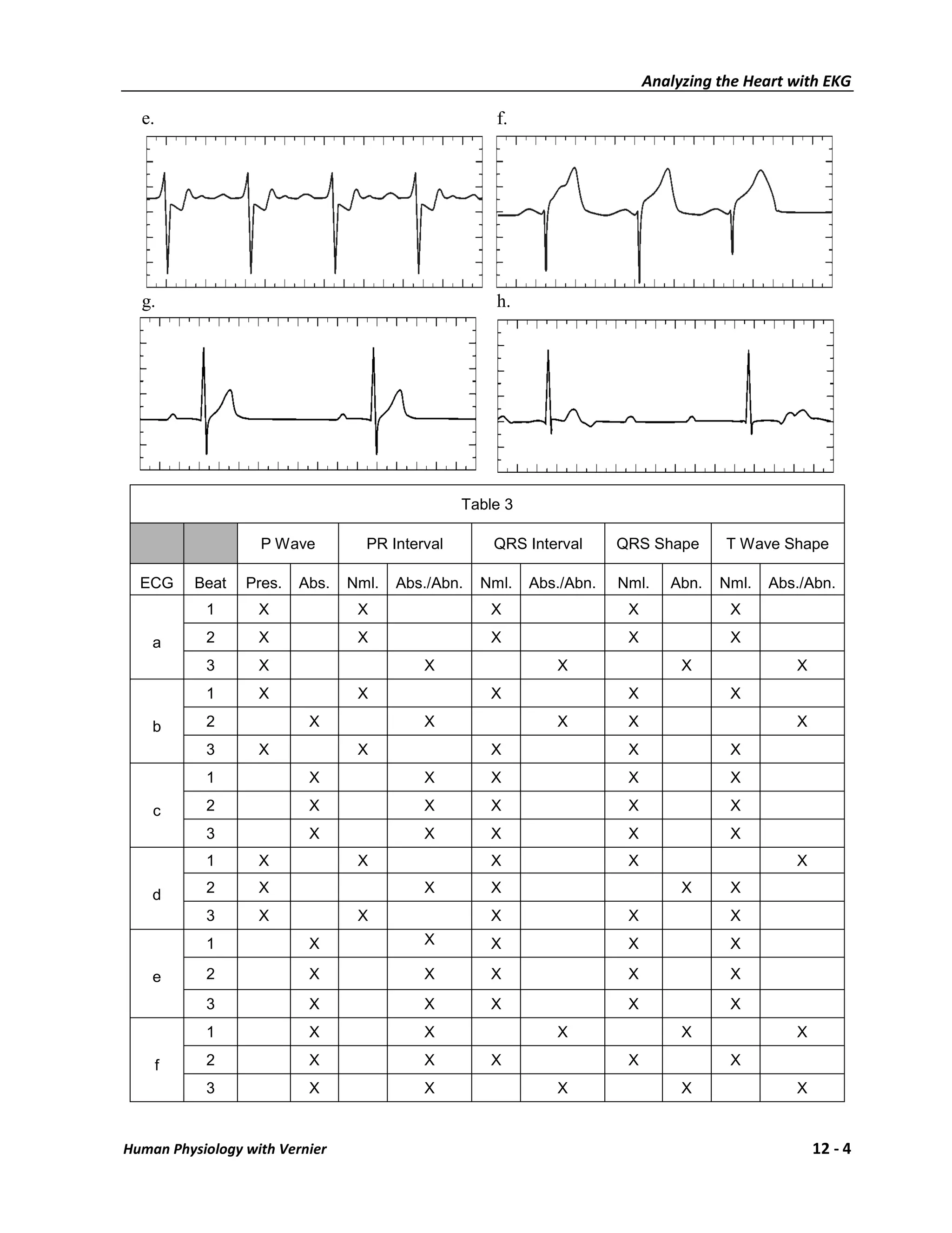 Ekg lab | DOCX