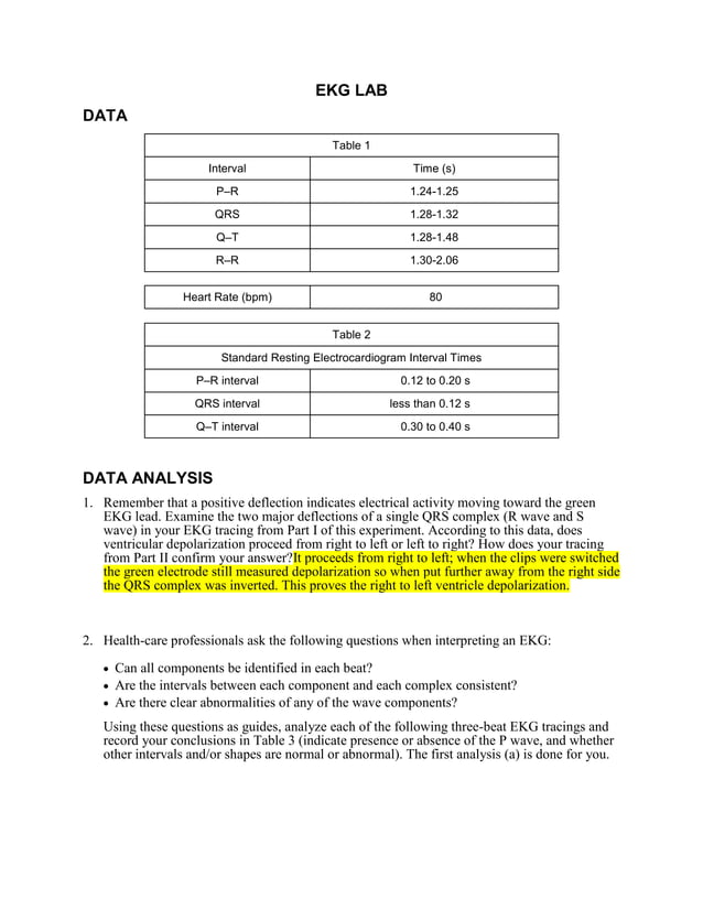 Ekg Lab 2 | PDF