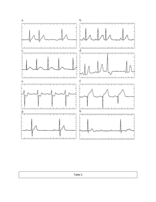Ekg Lab 2 | PDF