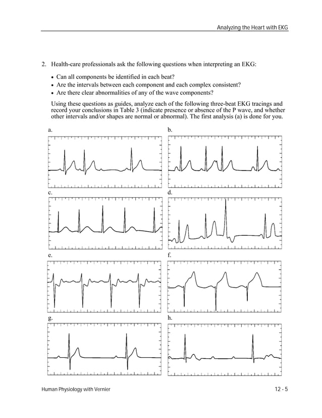 Ekg lab exp 3 | PDF