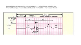 ekg master presentation for er master Student number 1 .pptx