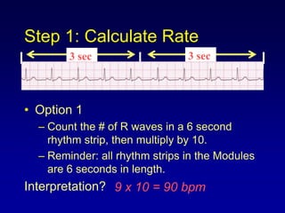 Ekg module 2 | PPTX