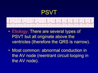 Ekg module 4b-1 | PPTX
