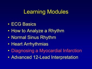 Ekg module 5 | PPT
