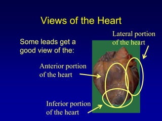 Ekg module 5 | PPTX