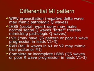 ekg_myocardial_infarction_ischemic_states.ppt