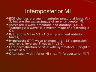 ekg_myocardial_infarction_ischemic_states.ppt