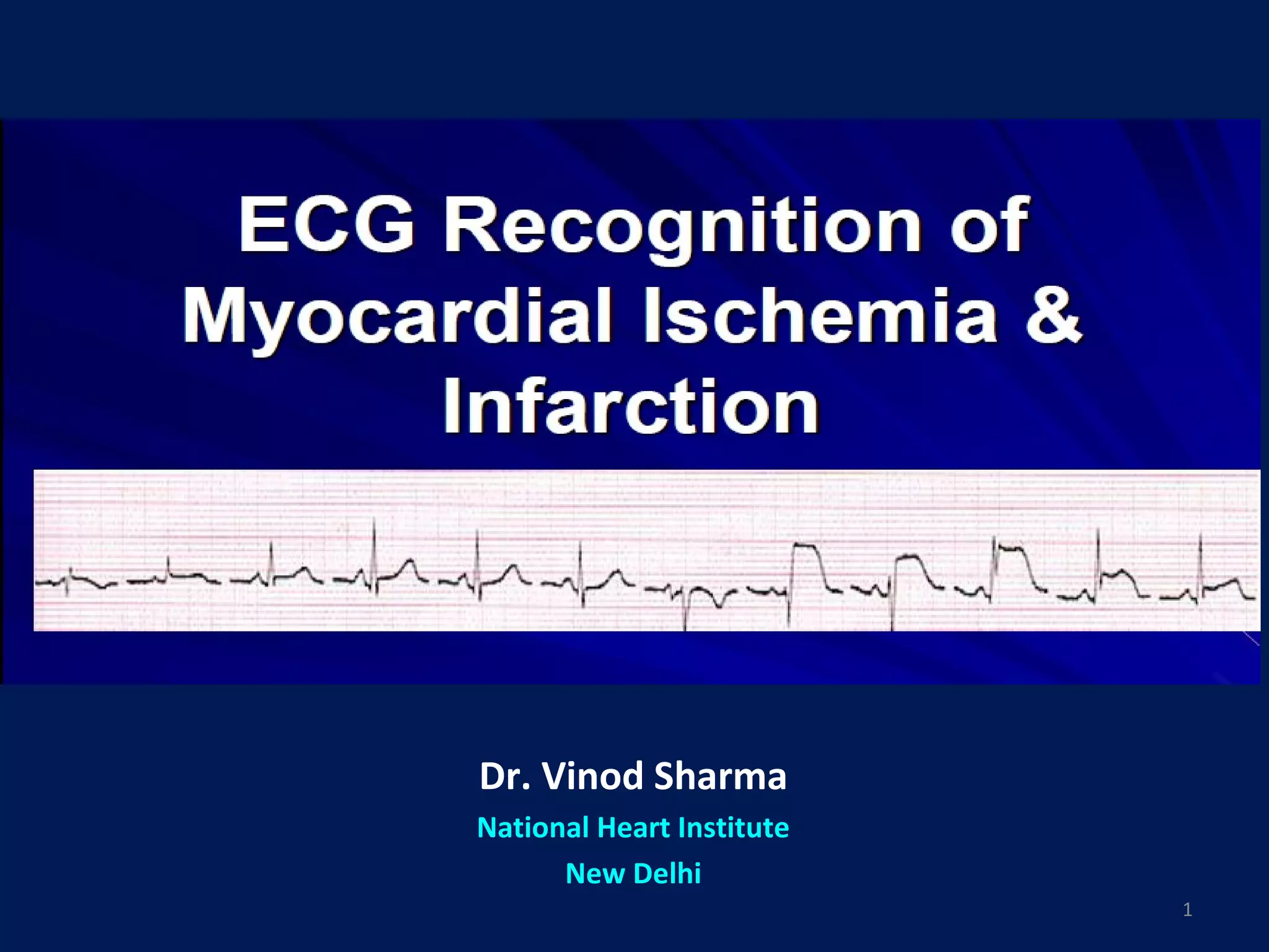 Ekg myocardial ischemia & Infarction | PPT