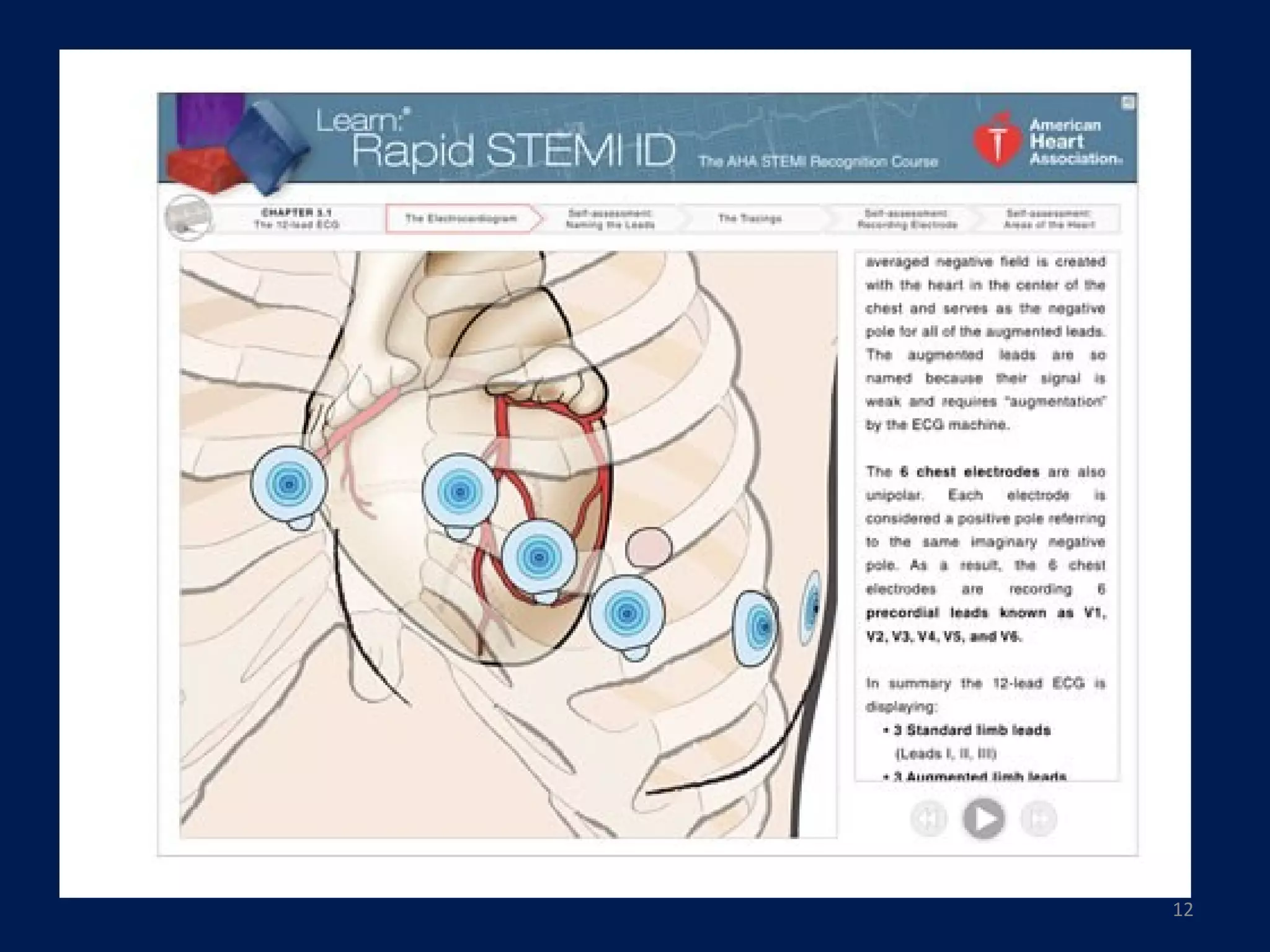 Ekg myocardial ischemia & Infarction | PPT