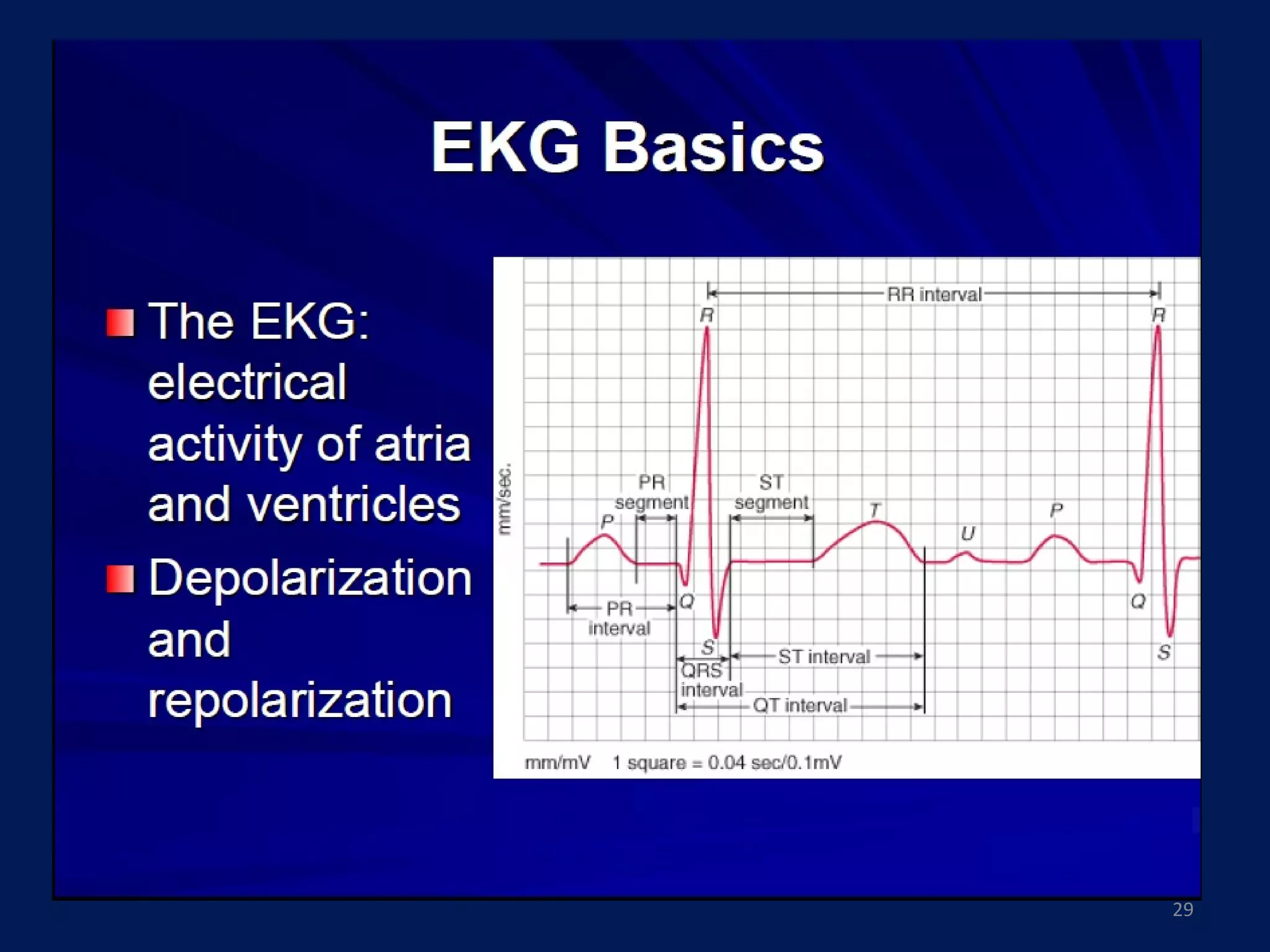 Ekg myocardial ischemia & Infarction | PPT