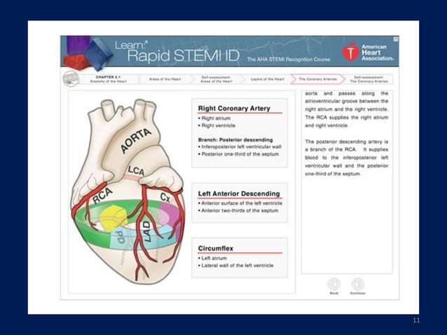 Ekg myocardial ischemia & Infarction | PPT