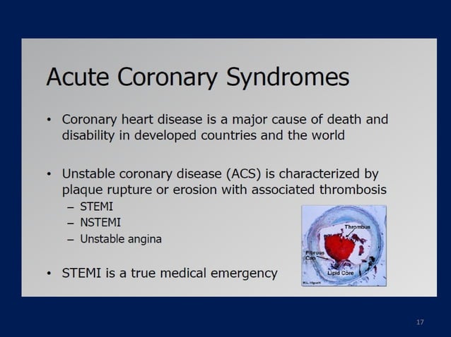 Ekg myocardial ischemia & Infarction | PPT