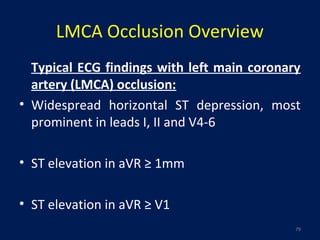 Ekg myocardial ischemia & Infarction | PPT