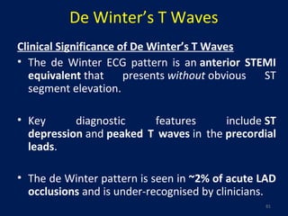 Ekg myocardial ischemia & Infarction | PPT