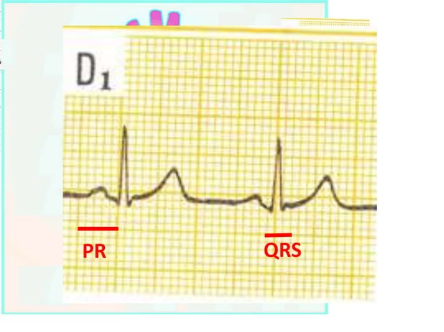 EKG normal.pptx