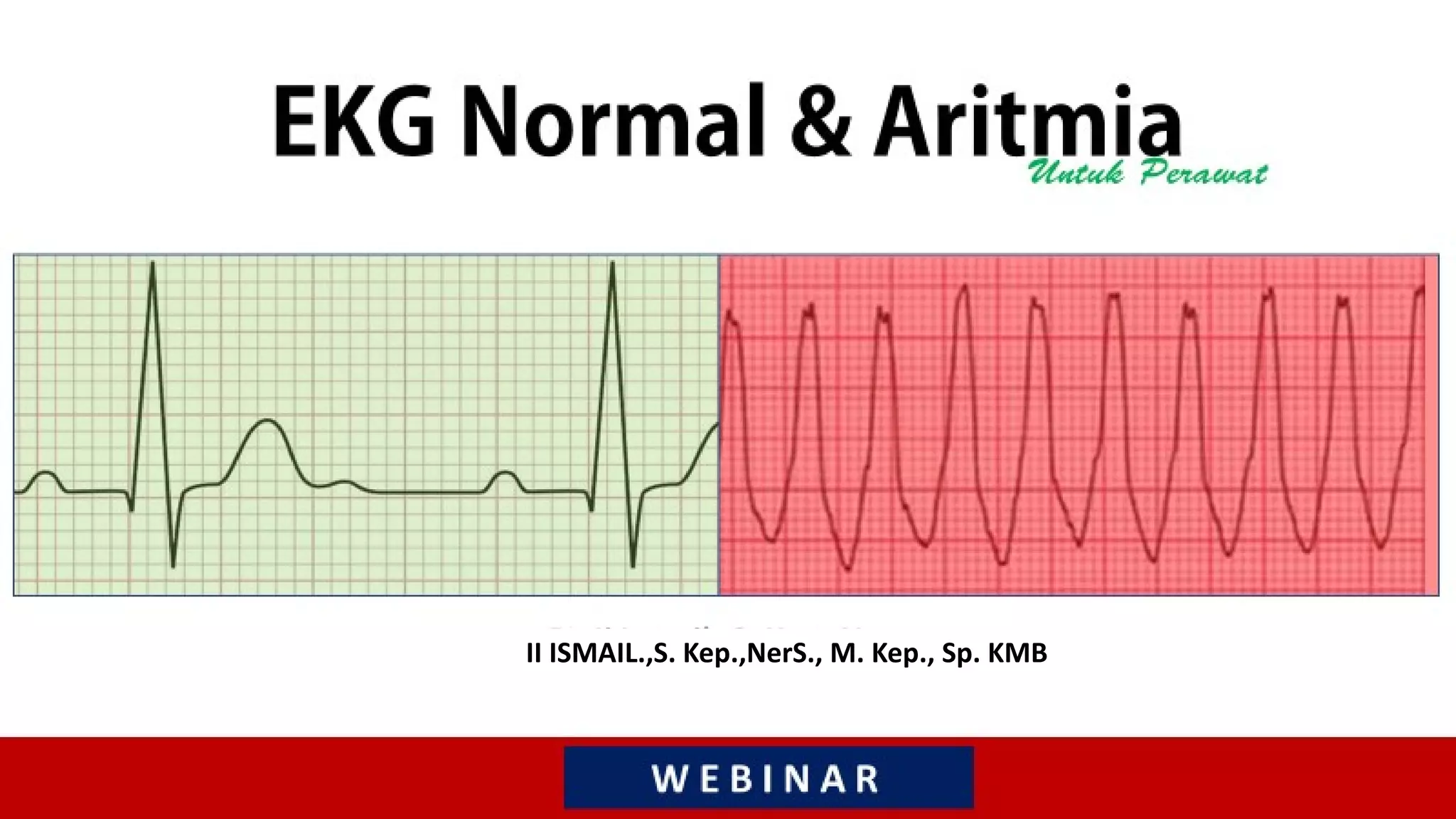 EKG Normal & Aritmia dari II Ismail UNTUK PESERTA .pdf