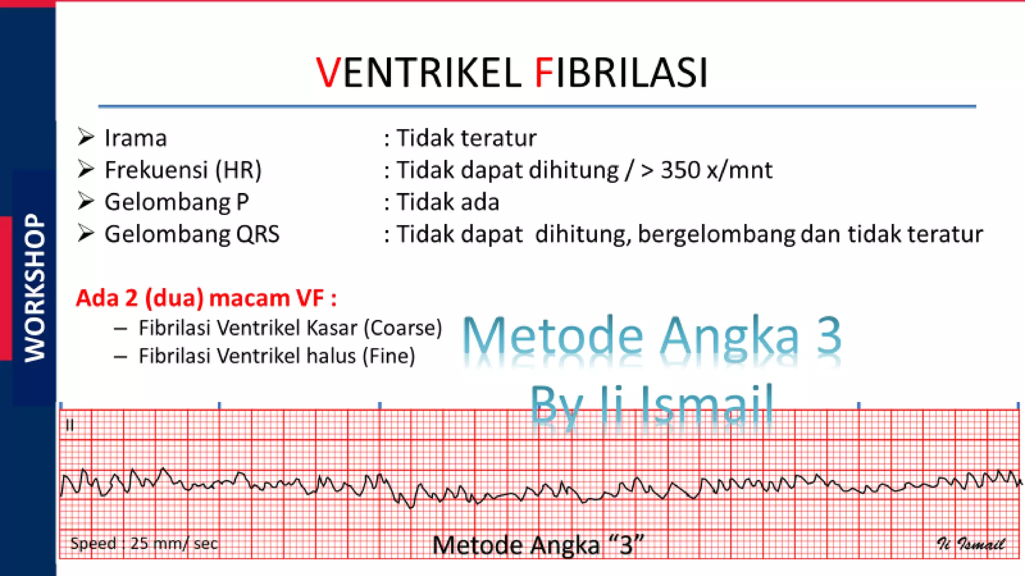 EKG Normal & Aritmia dari II Ismail UNTUK PESERTA .pdf