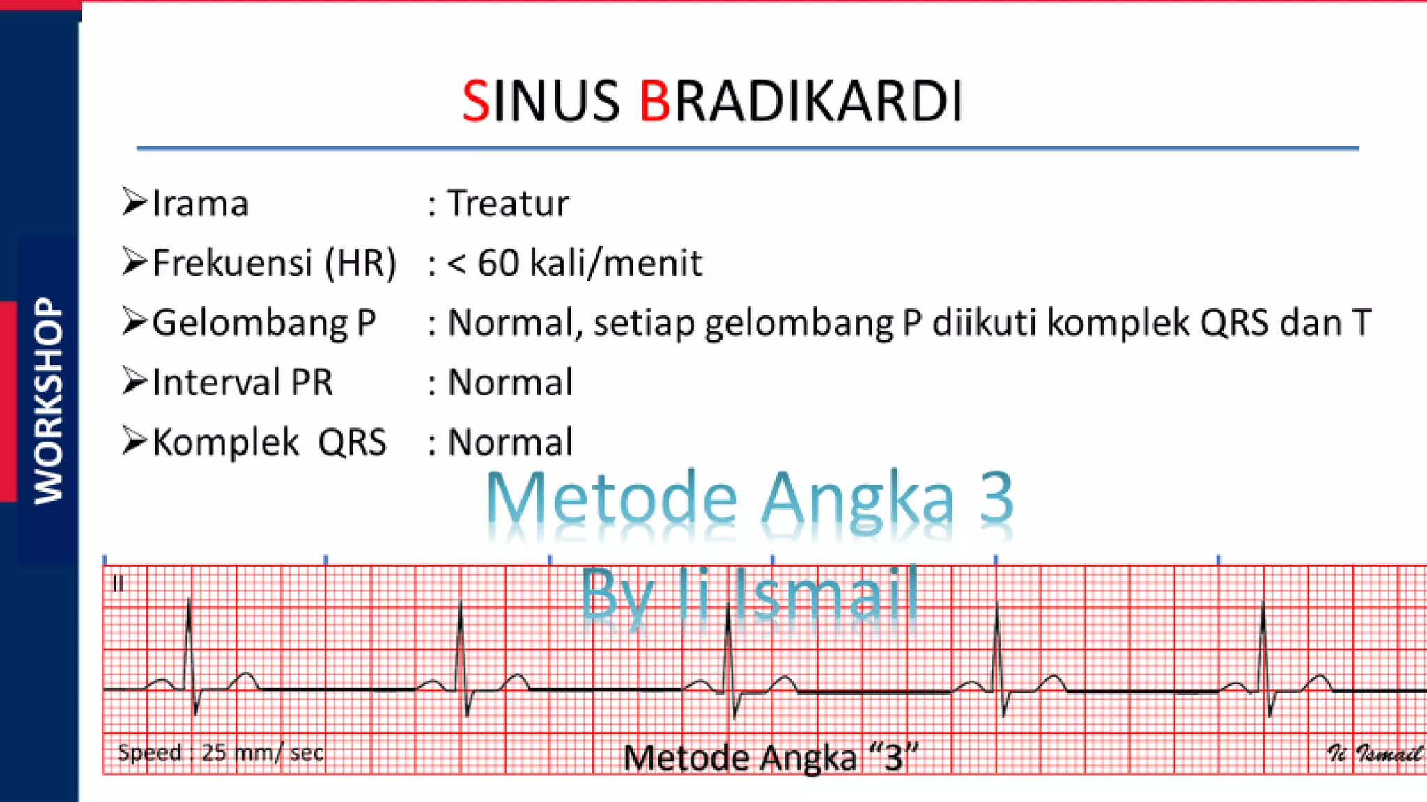 EKG Normal & Aritmia dari II Ismail UNTUK PESERTA .pdf