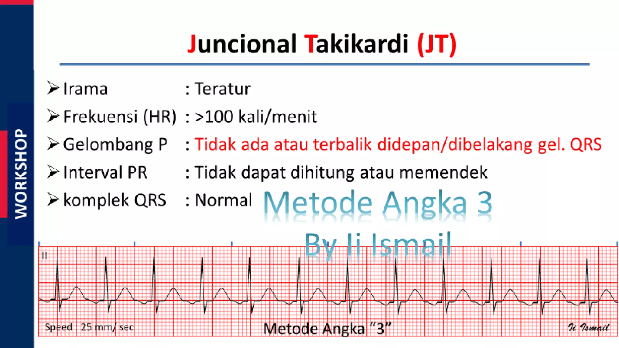 EKG Normal & Aritmia dari II Ismail UNTUK PESERTA .pdf