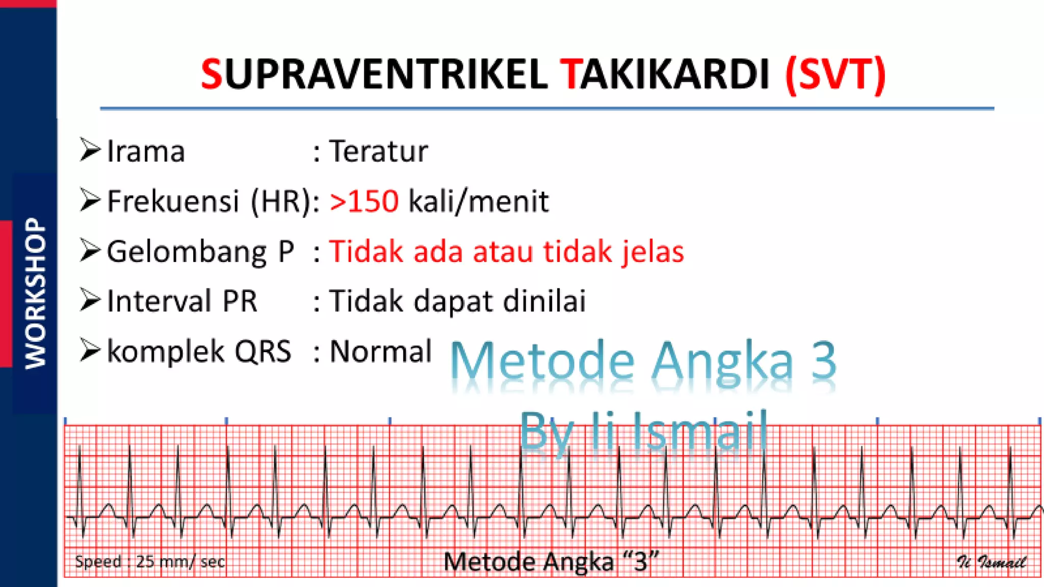EKG Normal & Aritmia dari II Ismail UNTUK PESERTA .pdf