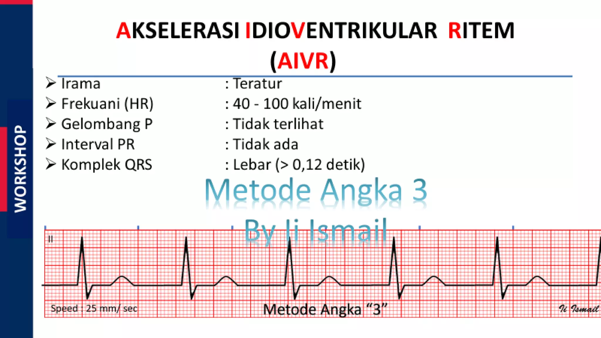 EKG Normal & Aritmia dari II Ismail UNTUK PESERTA .pdf