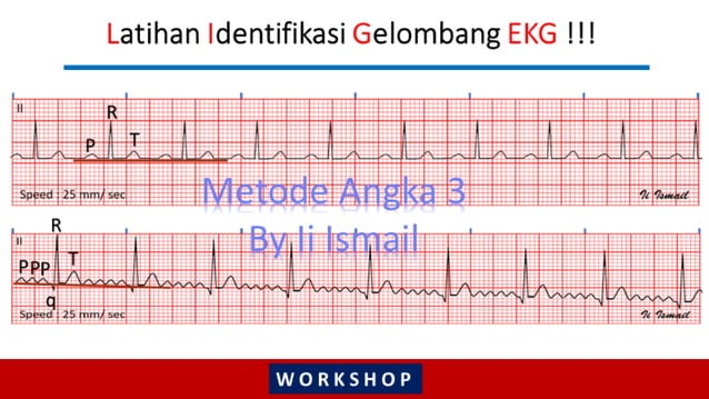 EKG Normal & Aritmia dari II Ismail UNTUK PESERTA .pdf