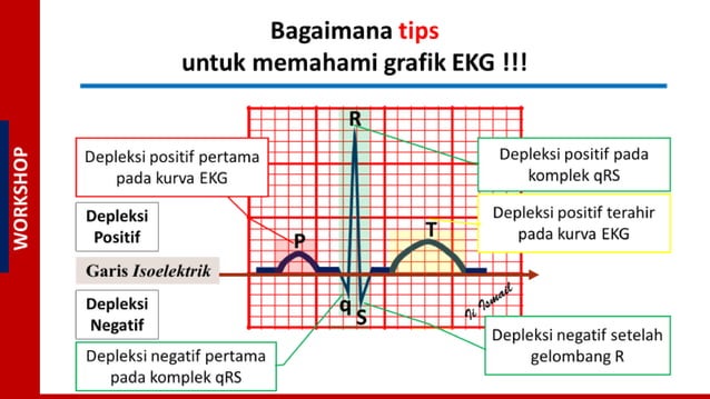 EKG Normal & Aritmia dari II Ismail UNTUK PESERTA .pdf