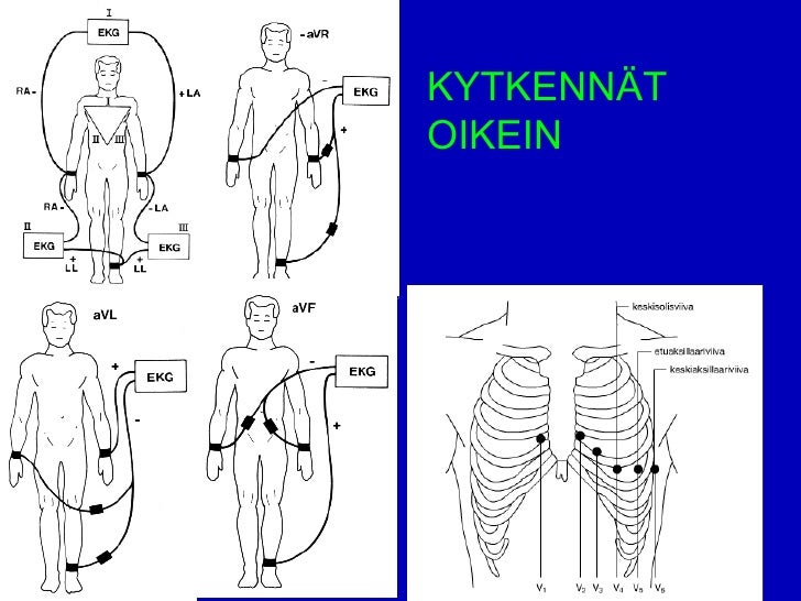 Ekgnperusteet1