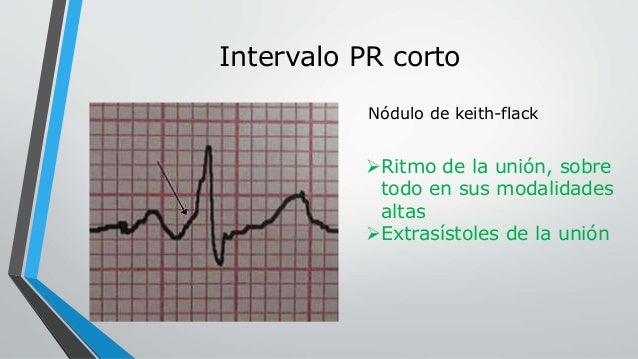 Ekg patologico