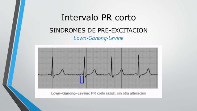 Ekg patologico