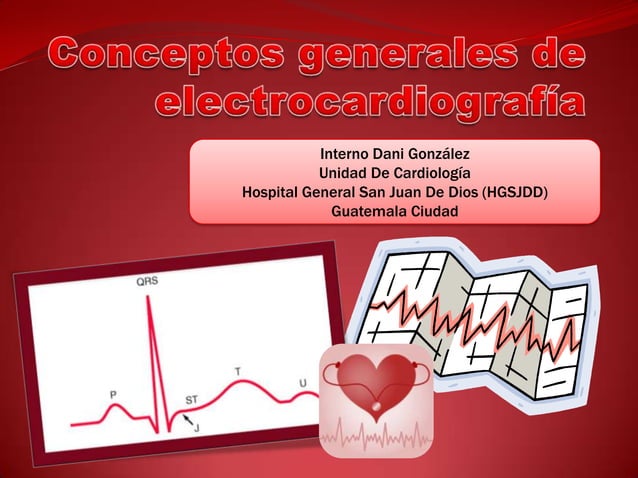 Electrocardiograma Normal