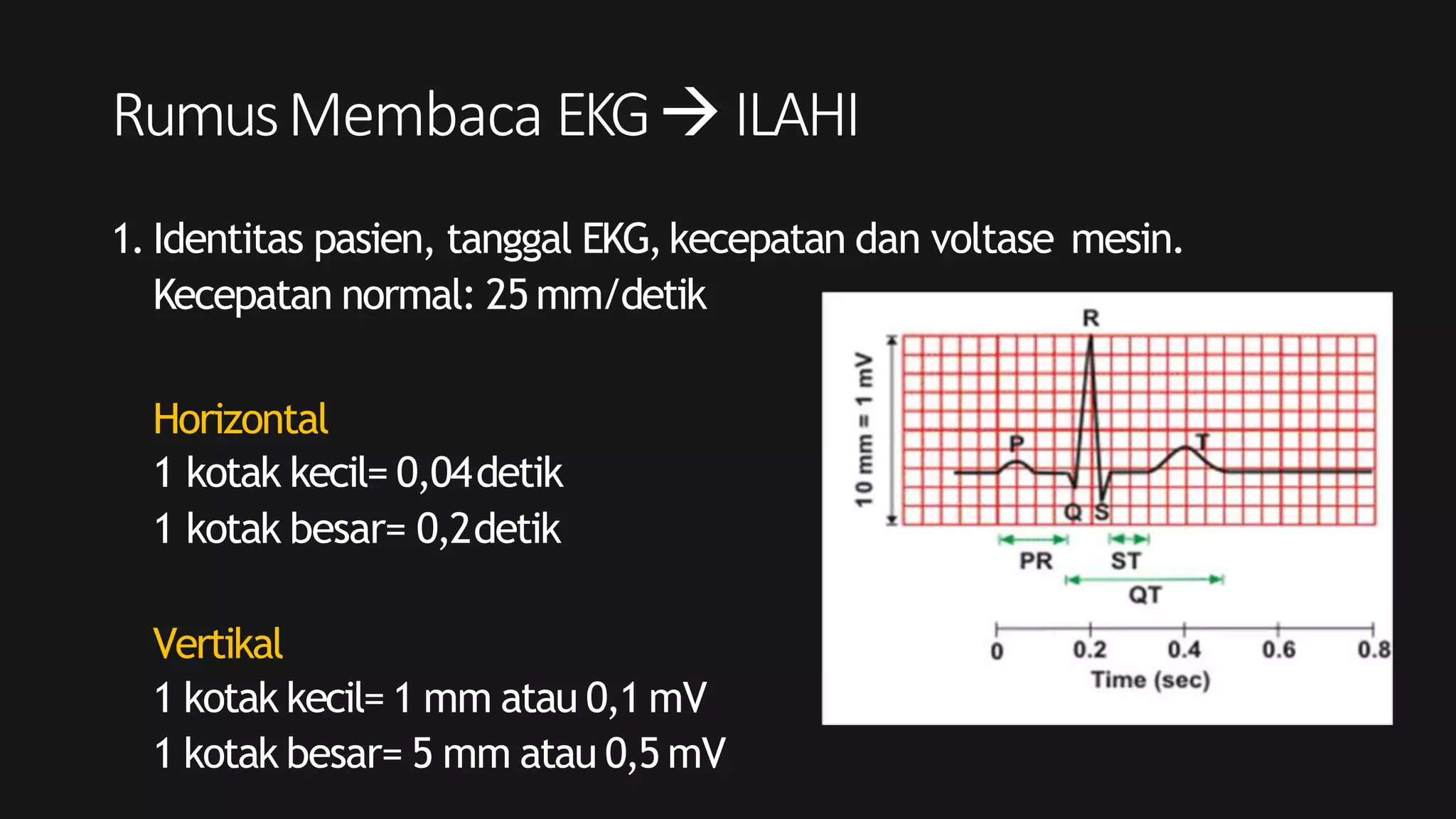 EKG part 1.pptx