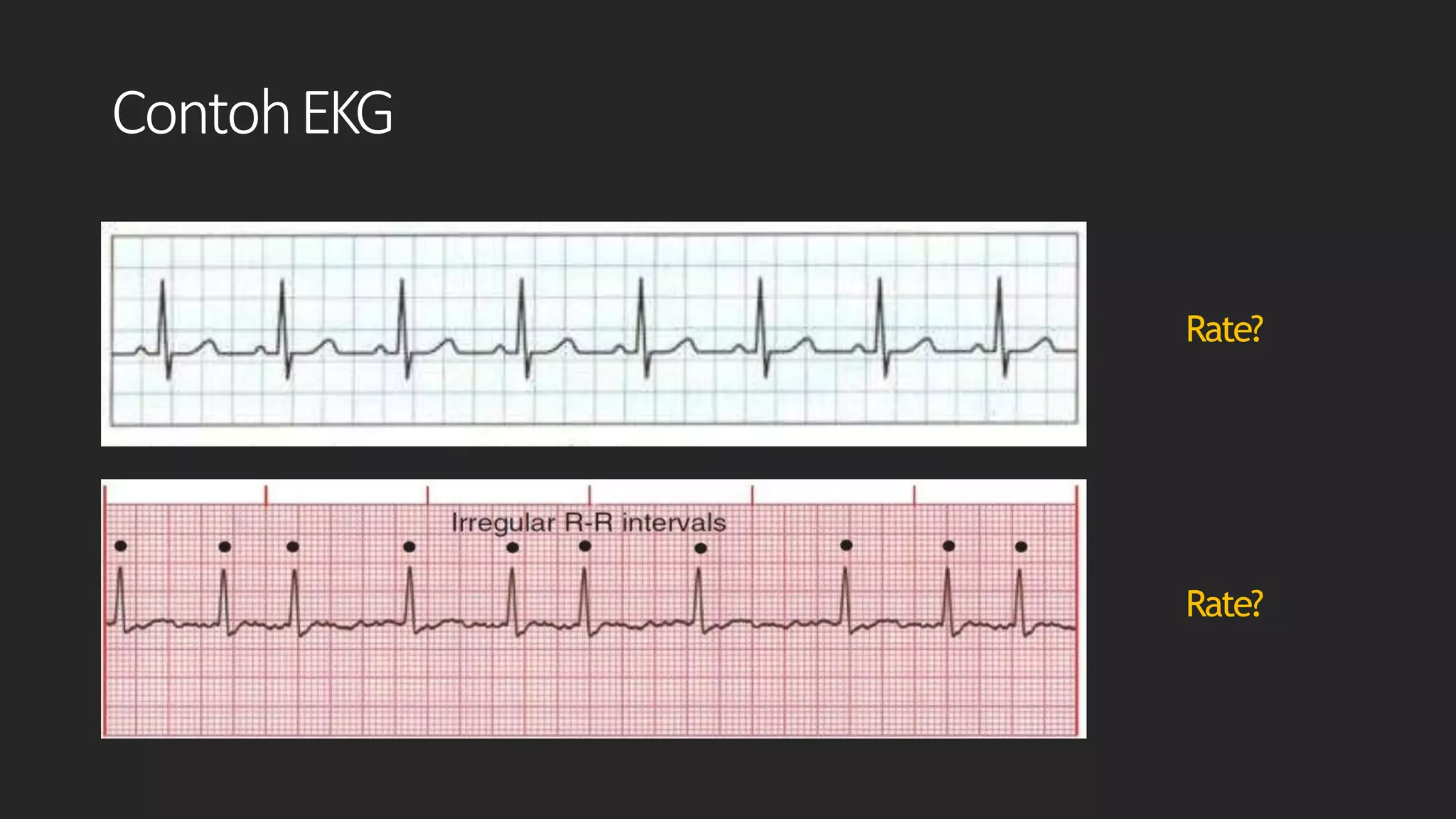 EKG part 1.pptx