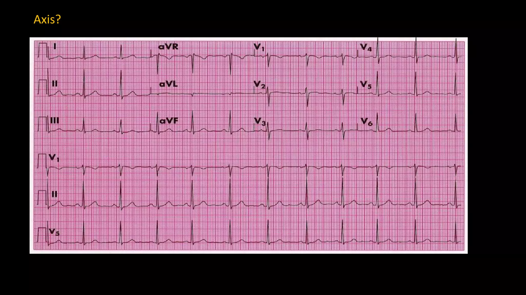 EKG part 1.pptx