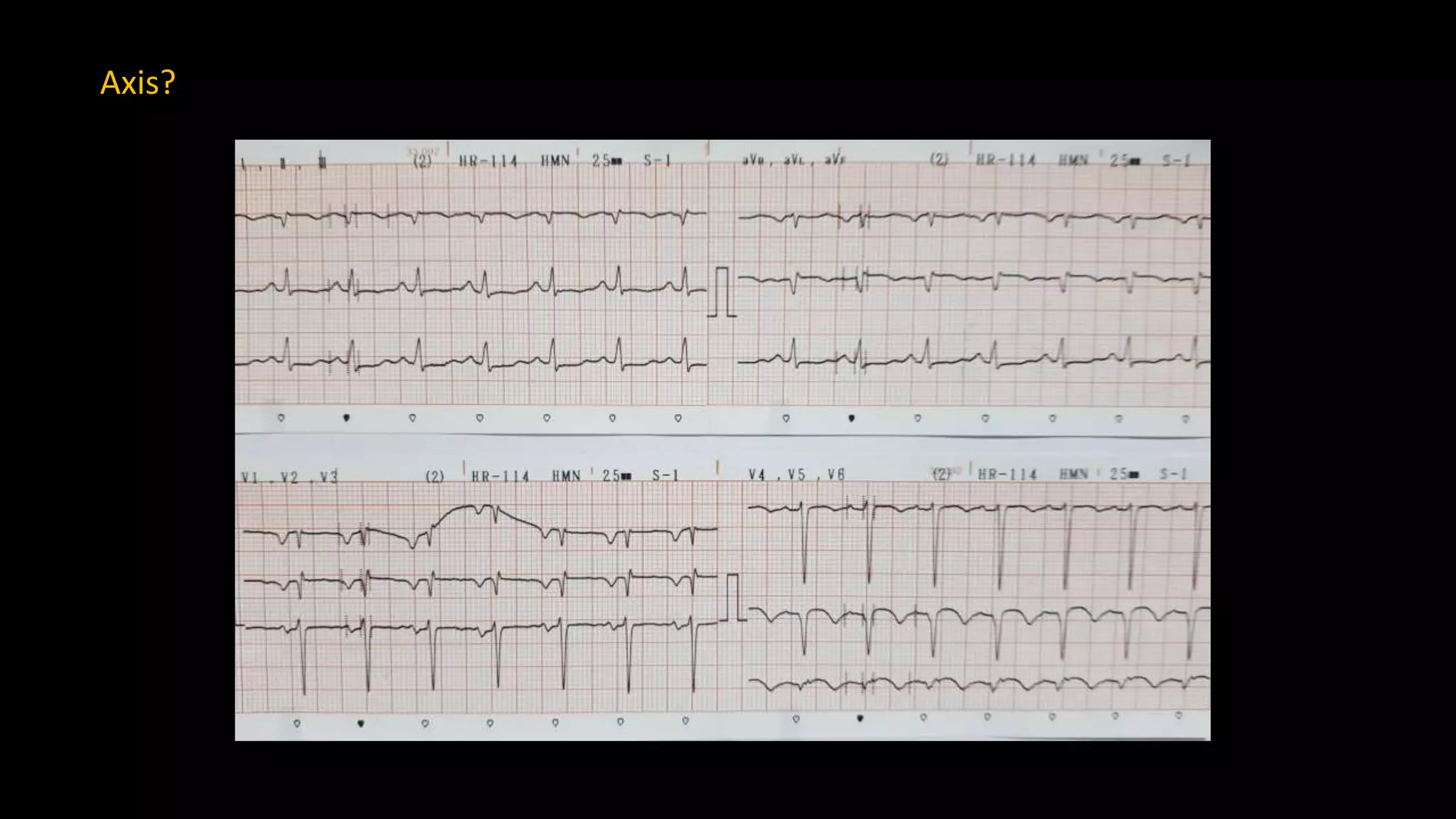 EKG part 1.pptx
