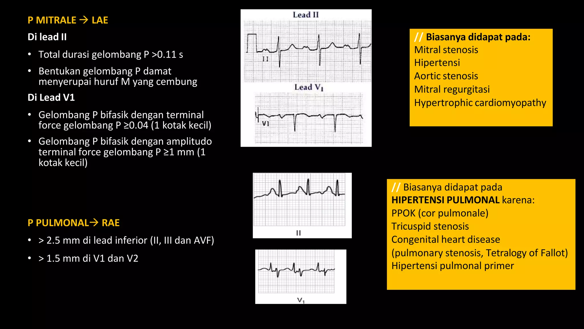 EKG part 1.pptx
