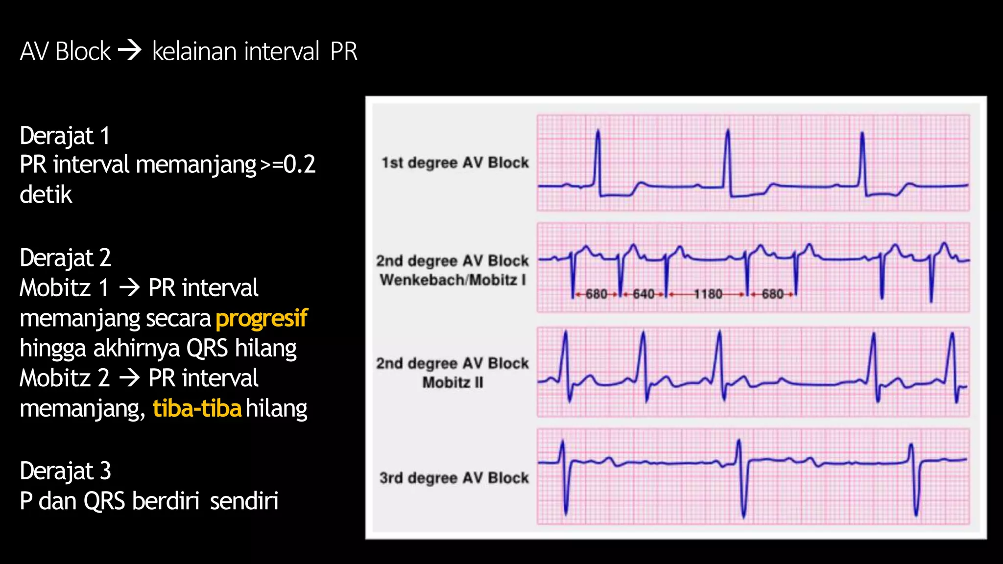 EKG part 1.pptx