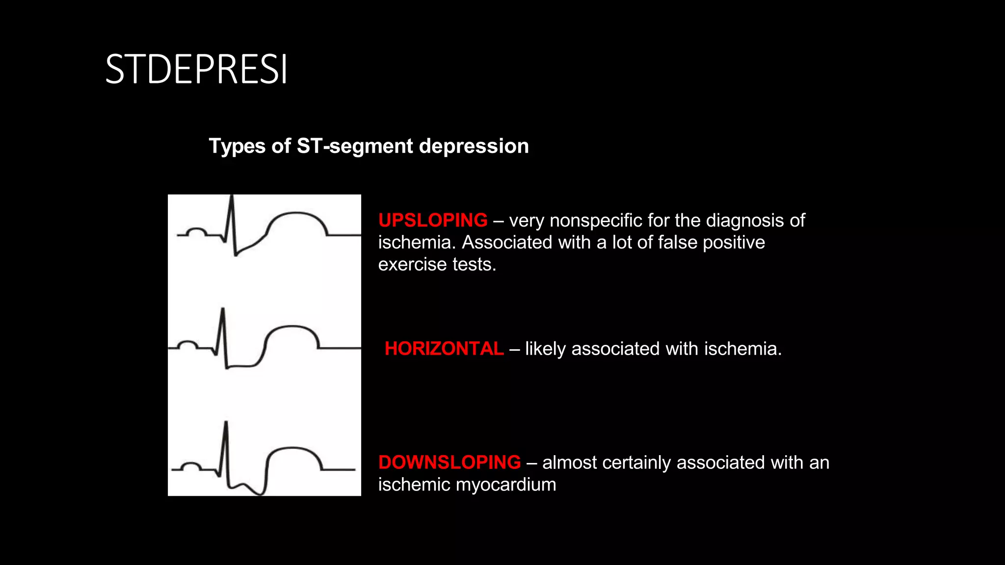 EKG part 1.pptx