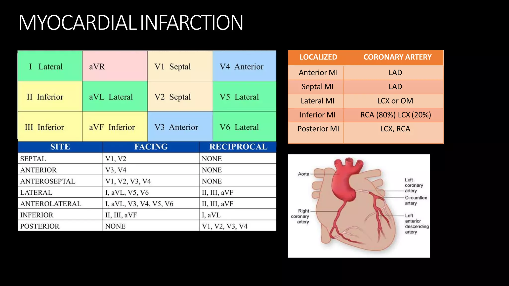 EKG part 1.pptx