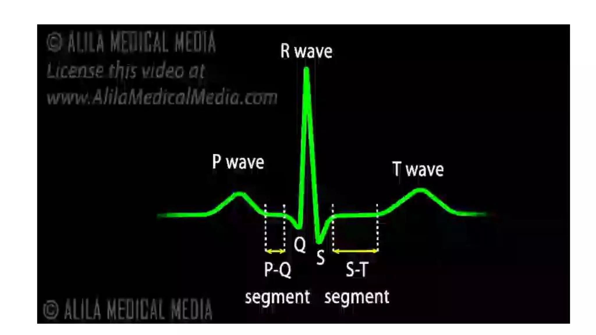 EKG part 1.pptx