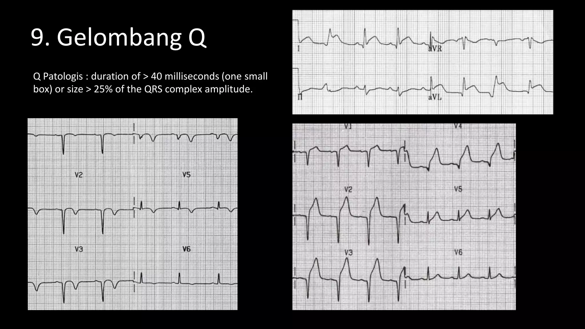 EKG part 1.pptx