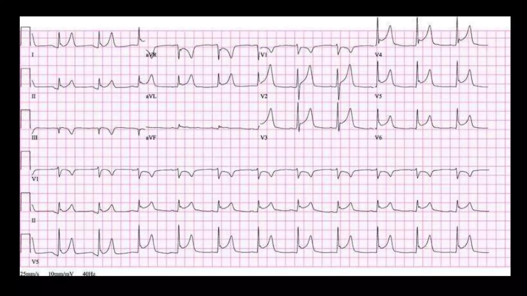 EKG part 1.pptx