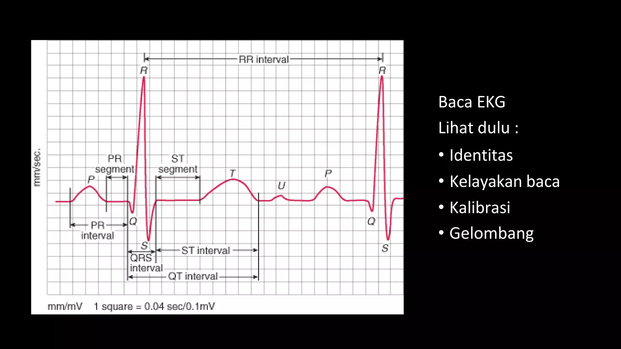 EKG part 1.pptx
