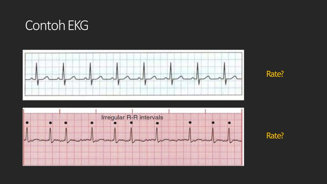 EKG part 1.pptx