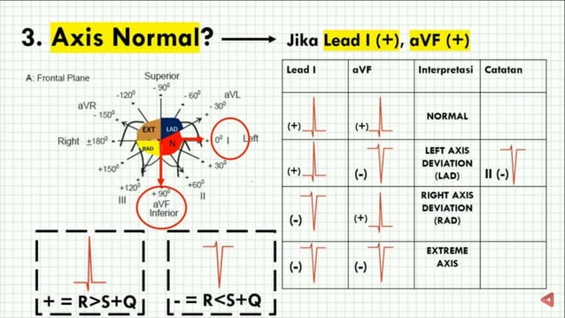 EKG part 1.pptx